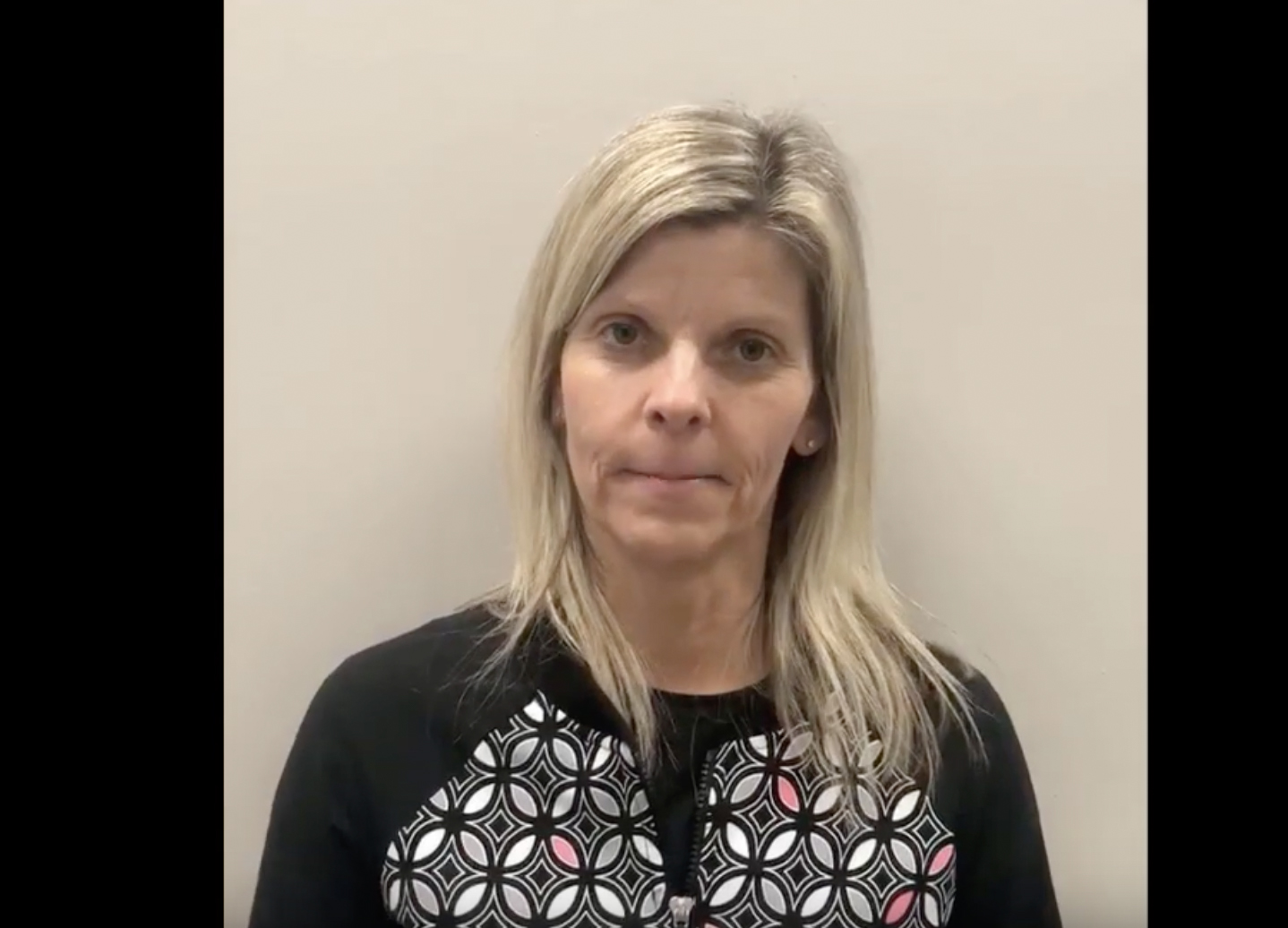 Dry Needling of a 46-year old scar - Myopain Seminars